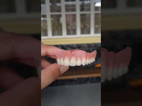 The Anatomy of a Processed Denture