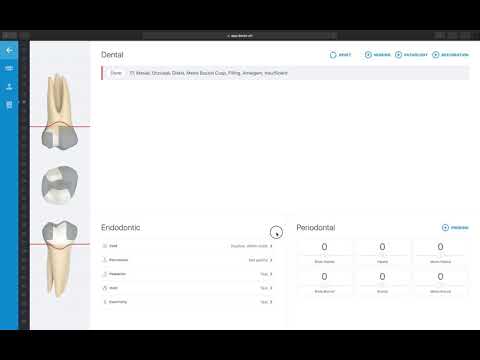 10. Endodontic examinations without AI  – derec® application walkthrough