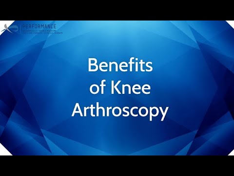 Benefits of Knee Arthroscopy