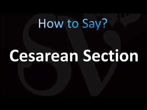 How to Pronounce ''Cesarean Section'' Correctly! (C-Section)