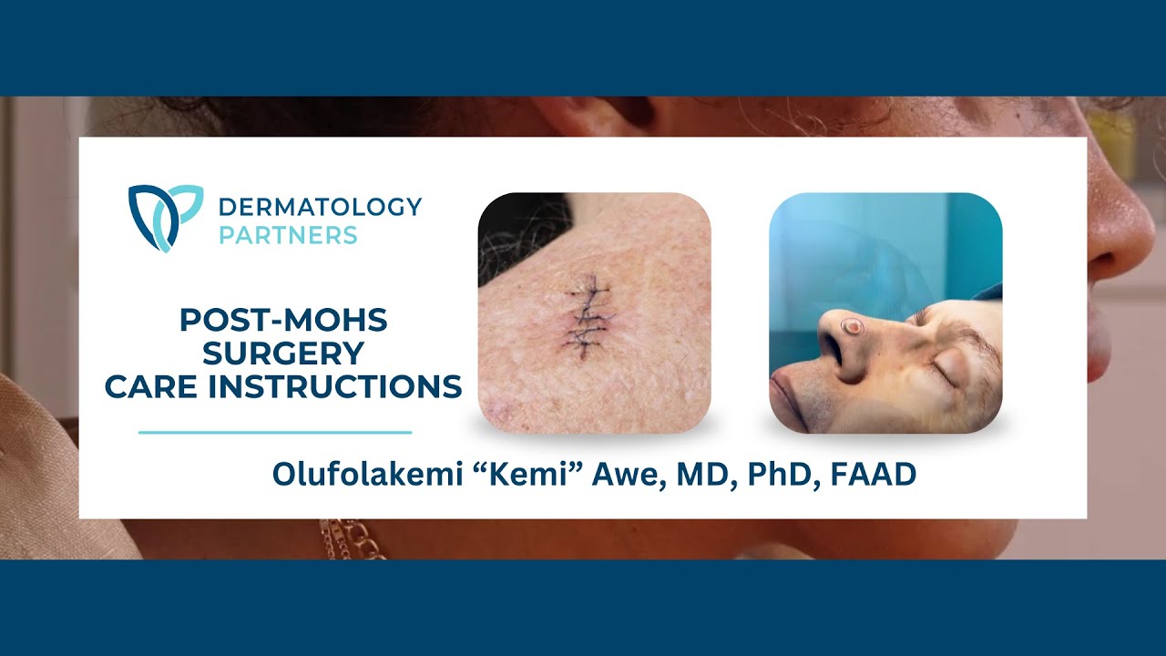 Post Wound Care Instructions from Olufolakemi 