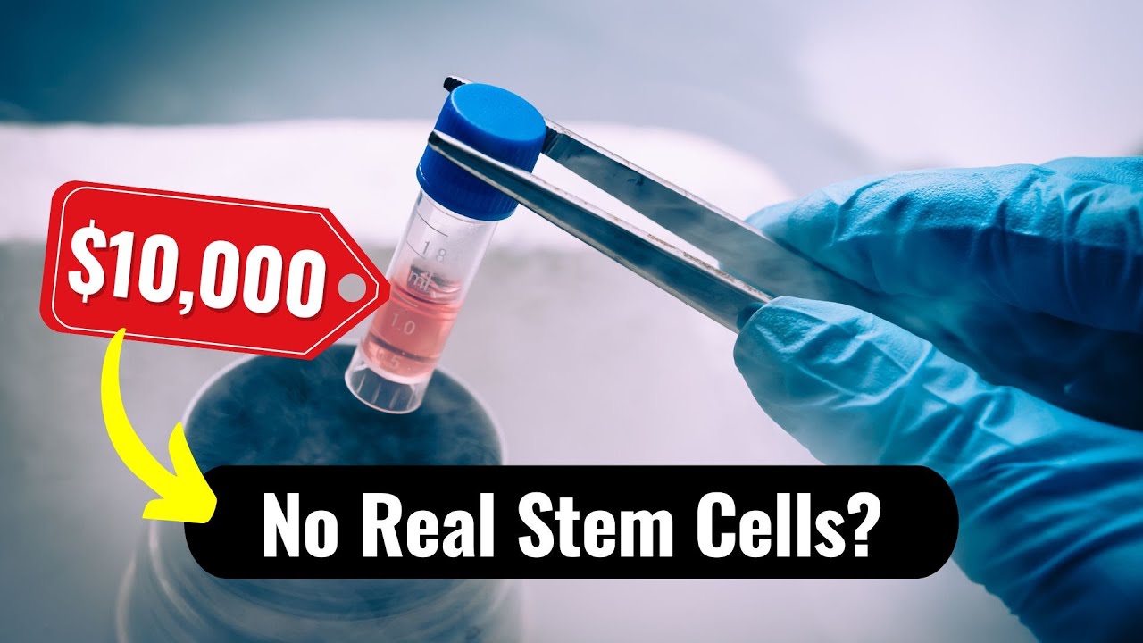 The Truth About Stem Cell Treatments Explained