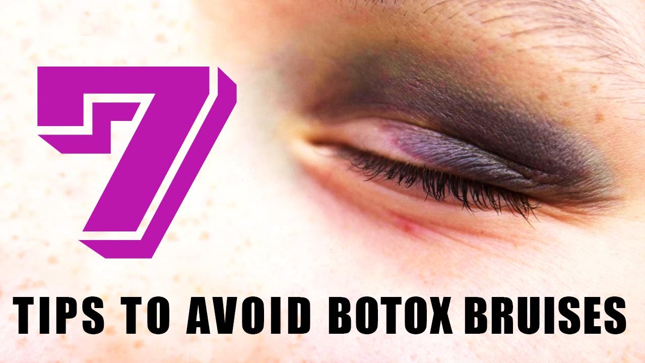 Bruising from Botox - 7 tips to avoid Botox Bruises