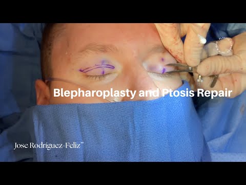 Blepharoplasty and Ptosis Repair
