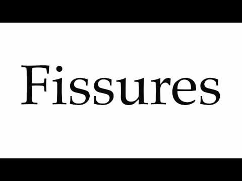 How to Pronounce Fissures