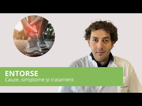 Entorse | Cauze, diagnostic și metode de tratament