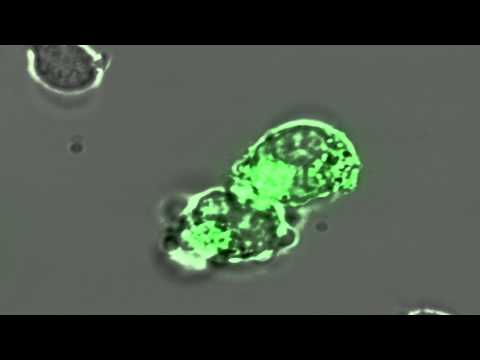 T cell killing CD19+ tumor cell (high resolution)