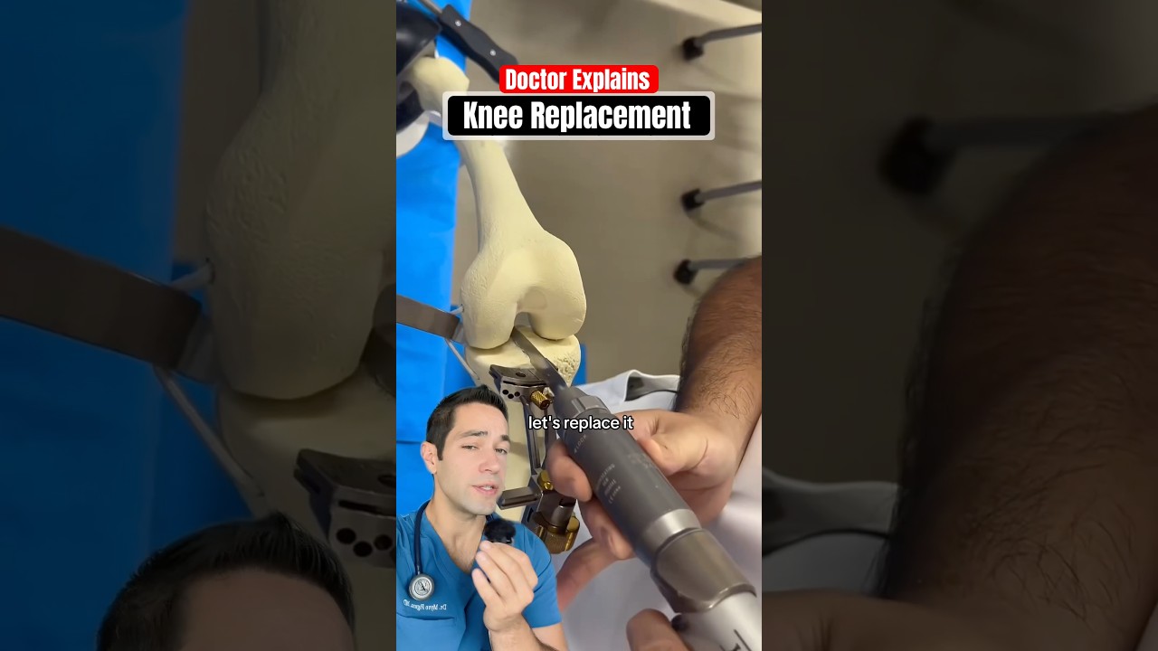 Doctor Explains: knee replacement surgery