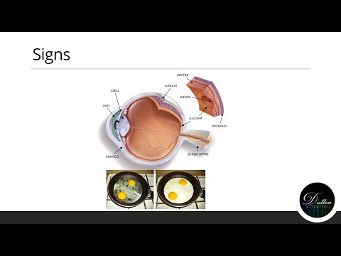 Patient Education Series - Cataract