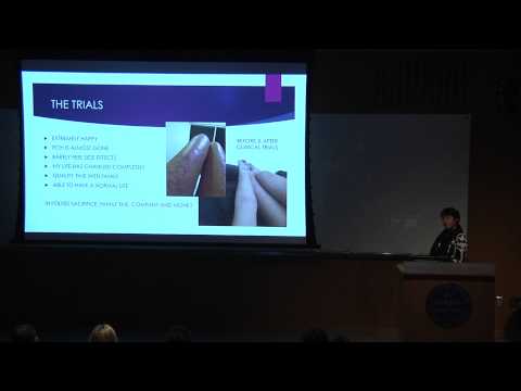 Hope for Eczema: New Treatment Developments Part 2