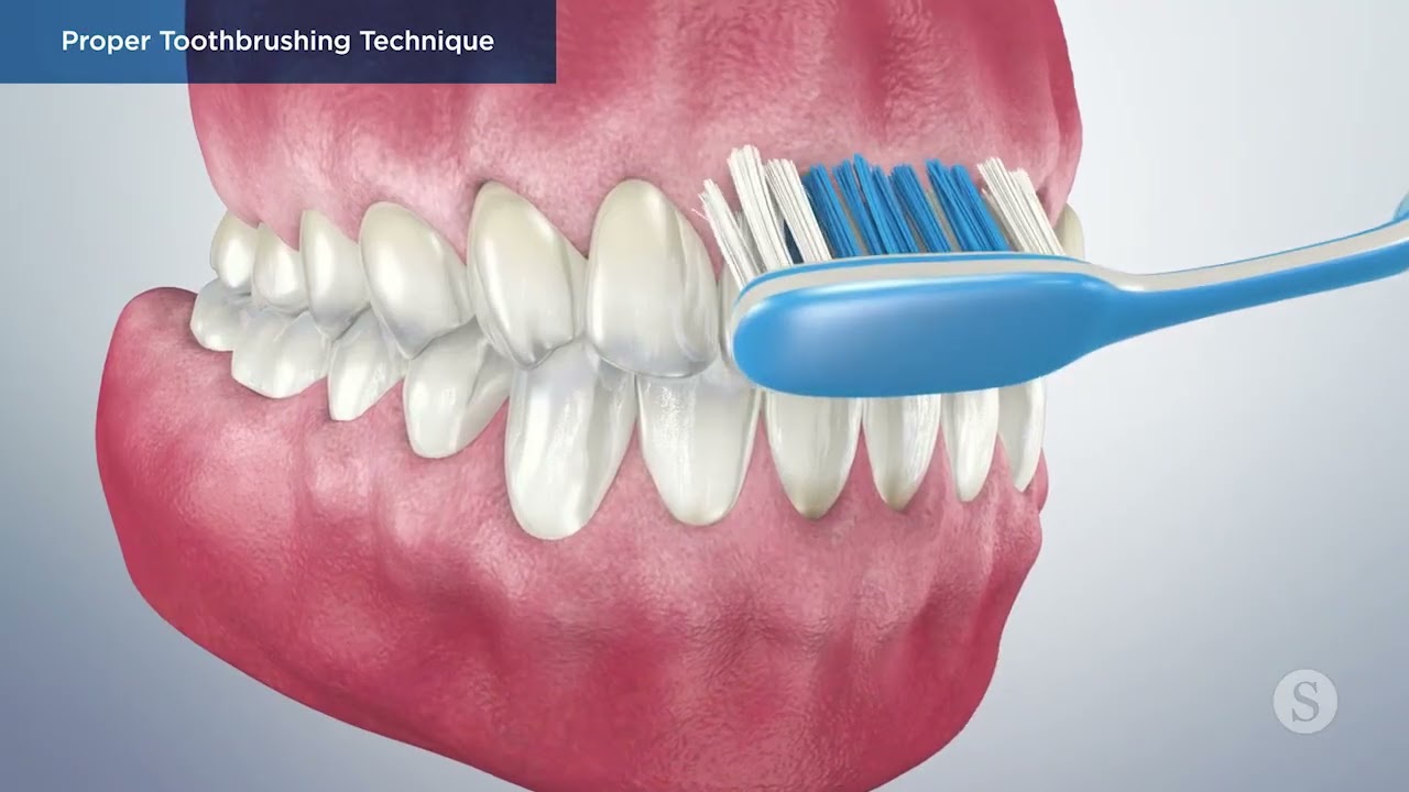 Proper Toothbrushing Techniques