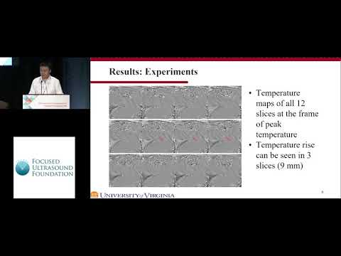 Xue Feng - Accelerated real-time 3D MR thermometry using a retraced spiral-in/out trajectory (2018)