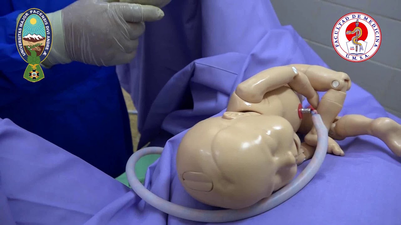 CHILDBIRTH AND DELIVERY