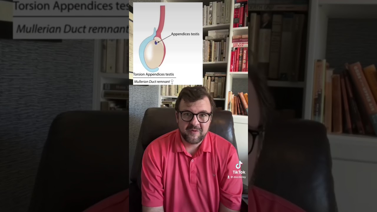 what is the appendix testis!? #urology #testicle