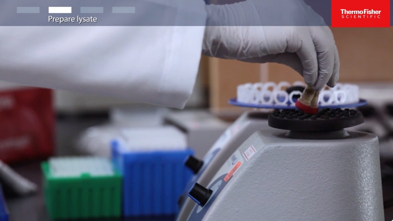 Stool DNA Extraction Guide | Microbial & Host DNA Purification