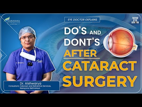 Essential Aftercare Tips Following Cataract Surgery: Your Guide to a Smooth Recovery!