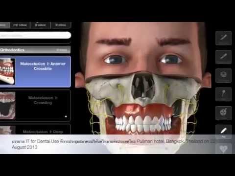 iPad (Information Technology) for dental use by Dr. Nattawut Wanumkarng