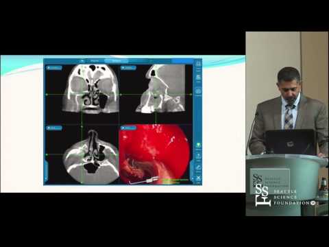 Dr. Rick Chandra's Most Interesting Rhinology Case