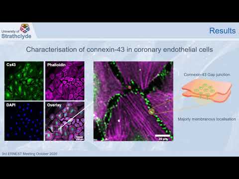 Chemotherapeutic drug doxorubicin affects connexin-43 in endothelial cells from the heart