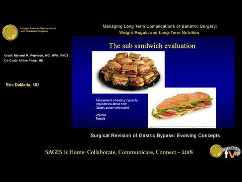 Surgical revision of gastric bypass: Evolving concepts