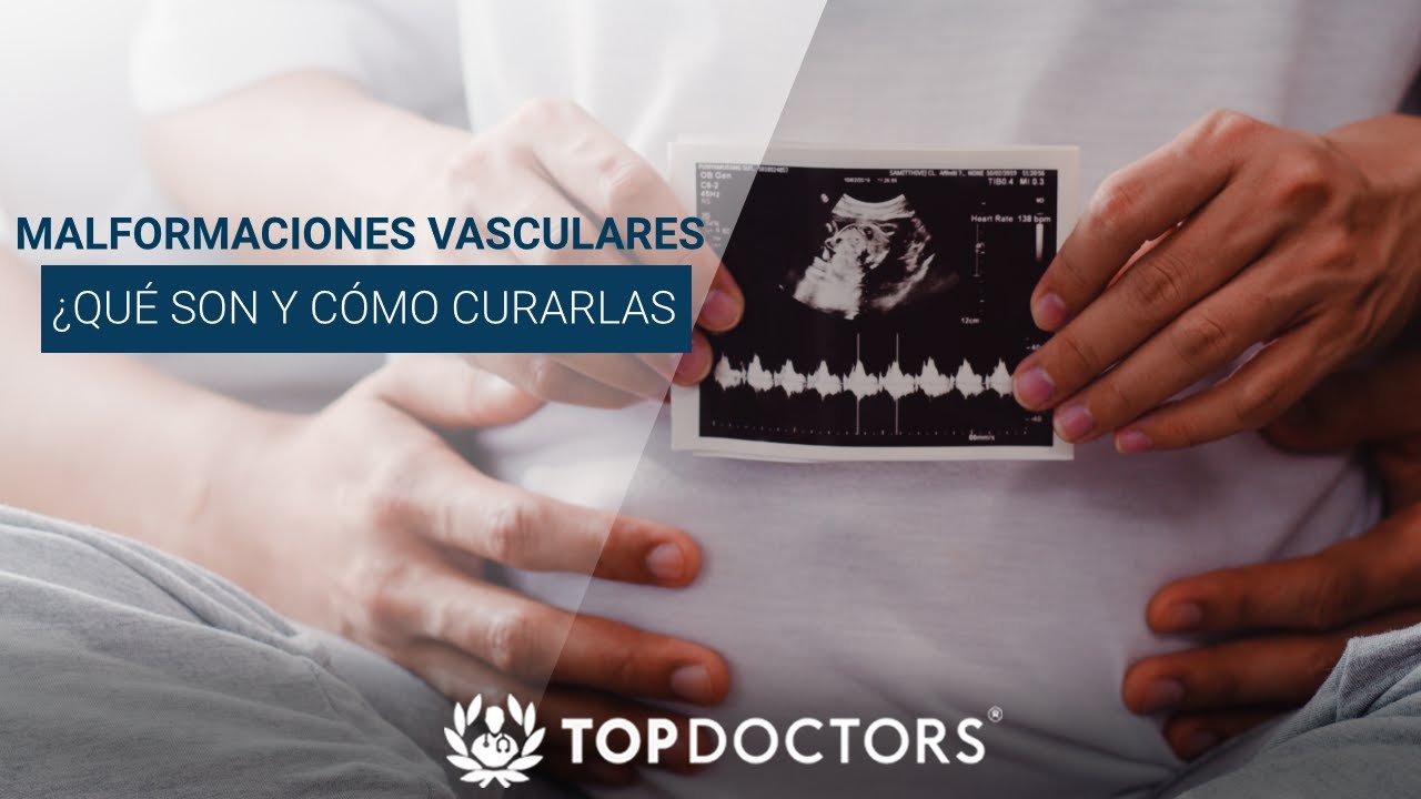 Vascular malformations: What are they and how can they be treated?