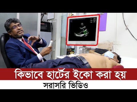 কখন ও কিভাবে হার্টের ইকো করা হয়, সরাসরি ভিডিও ECHO/Echocardiography Full Video I Meditalk 24