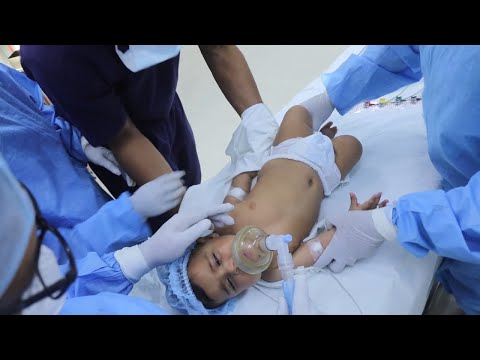 Pediatric ANESTHESIA procedure