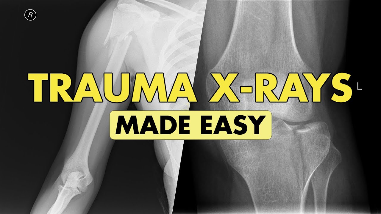Orthopedic X Ray Interpretation Basics Explained with Examples