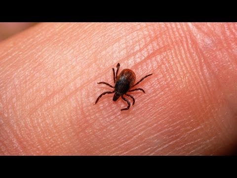 Camping Tick Protection Ideas | Youville – Camping Outdoors