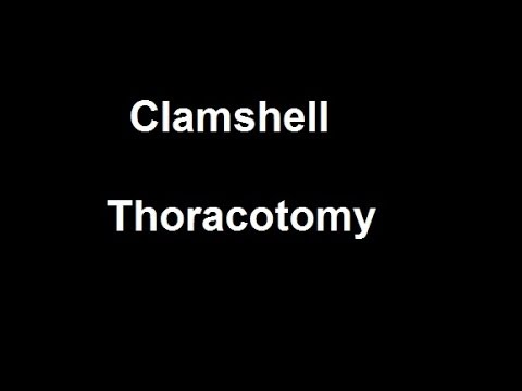 Clamshell Thoracotomy | Dr. Arvind Kumar ( Medanta, Gurgaon) +919773635888