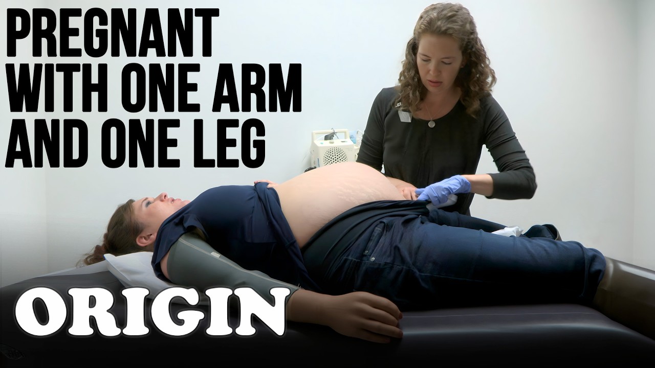 Having A Baby After Losing An Arm And Leg (Unbelievable Mom Story) | Extraordinary Pregnancies