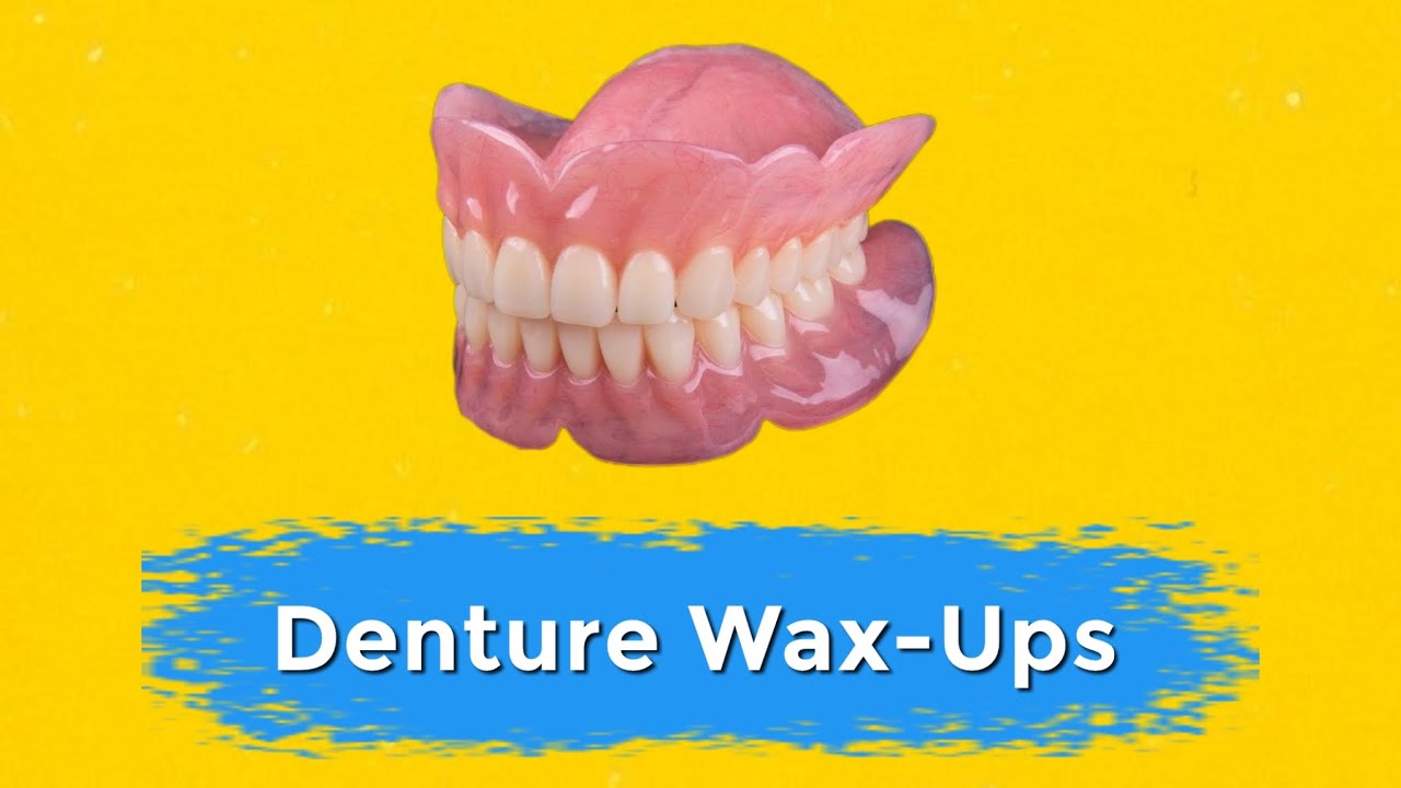 Dental Lab Denture Wax-Ups Tutorial