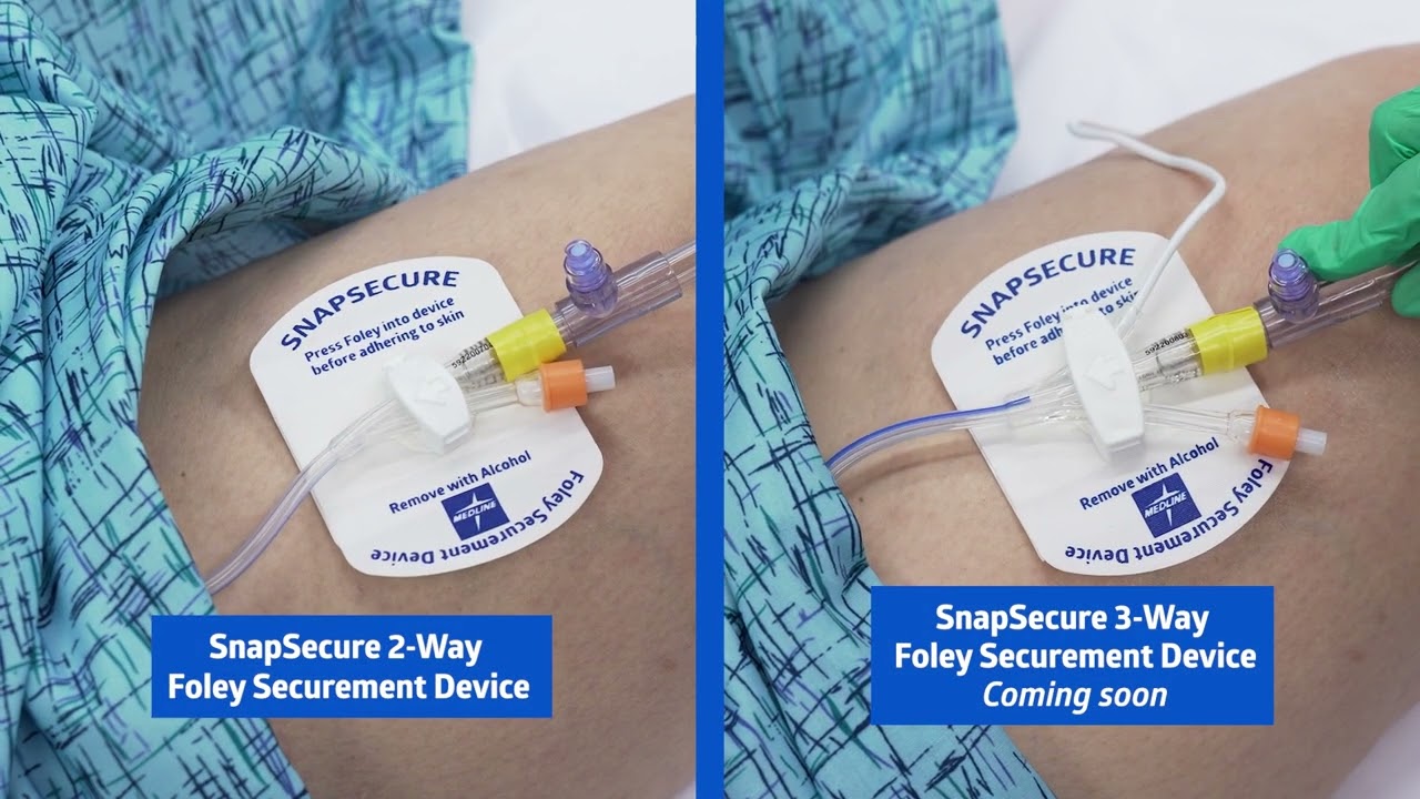 snapsecure foley securement device
