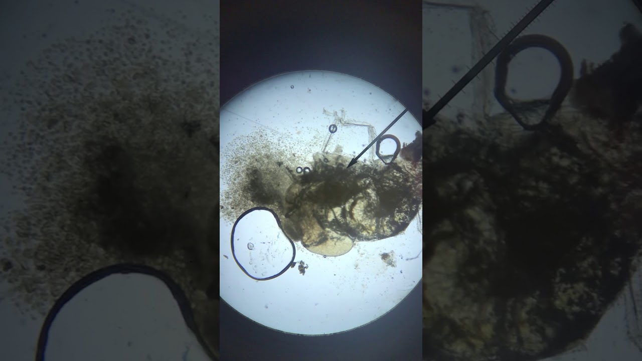 Termite Dissection Video