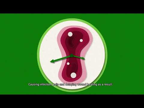 Wound Talks #7 Why care of peri-wound and surrounding skin is so important