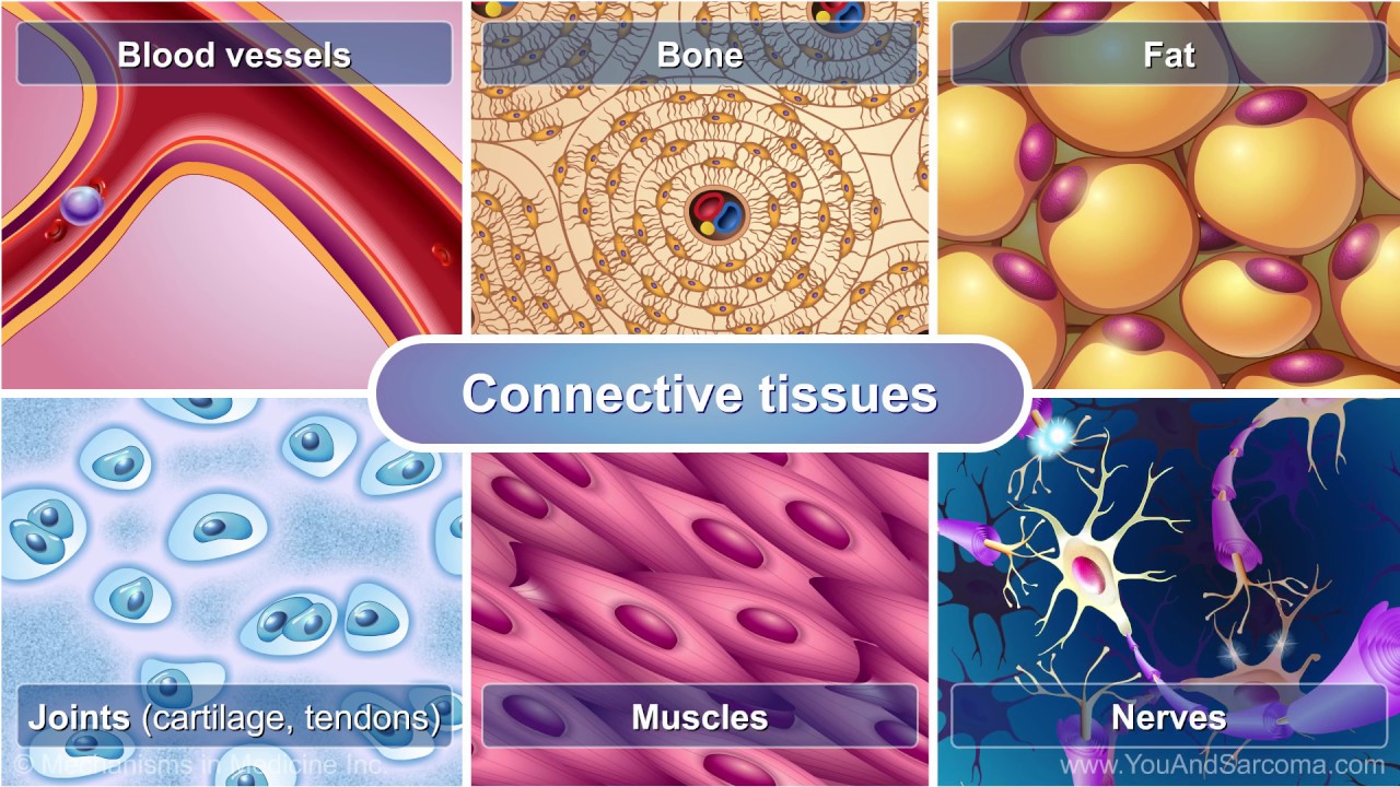 Understanding Soft Tissue Sarcoma