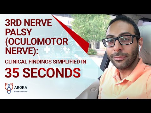 3rd Nerve Palsy (Oculomotor Nerve): Clinical findings simplified in 35 seconds