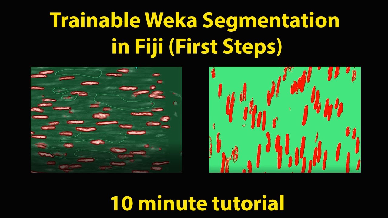 Trainable Weka Segmentation (Fiji Tutorial)