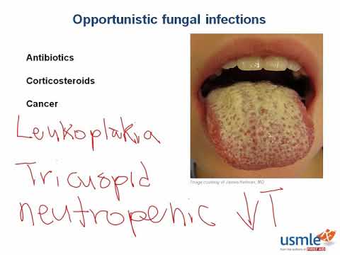 USMLE-Rx Express Video of the Week: Opportunistic Fungal Infections