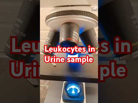 Leukocytes in Urine sample🔬 #leukocytes#wbc #labtechdt #laboratory#microscopy #pathology#sciencelab