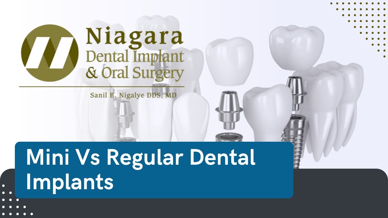 Mini Vs Regular Dental Implants