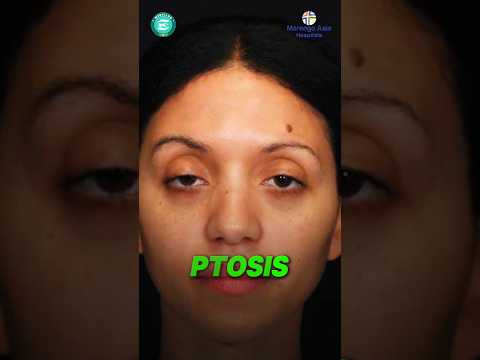 Neurological connection of eye problems? 🤔 | #eyeproblems due to brain issues? | Dr.Kunal Bahrani