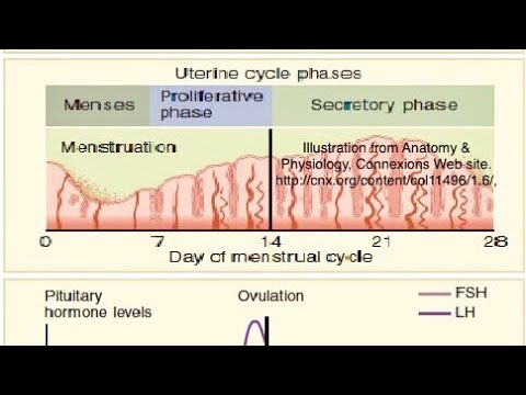 Amenorrhea etiology, pathophysiology, and workup