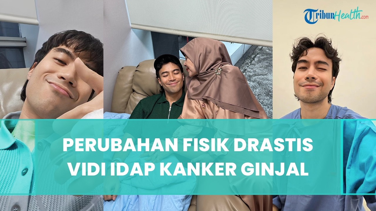 Sempat Terlihat Kurus dan Pucat, Perubahan Fisik Vidi Aldiano seusai ...