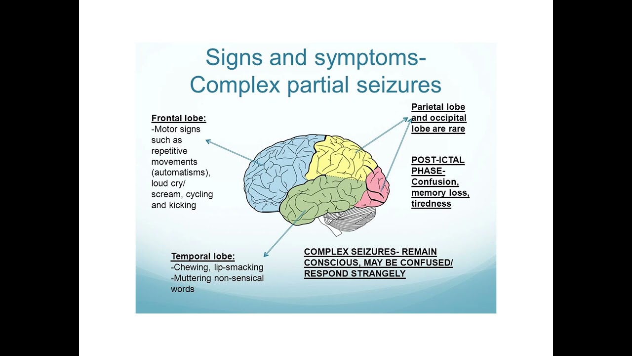 Epilepsy PPT (Slide Presentation)