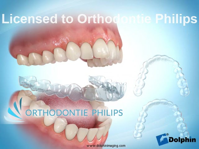 Appareil Dentaire Invisalign L'orthodontie Invisible, Grâce Aux