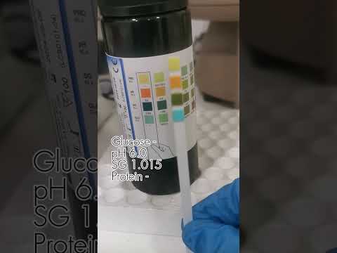 How to know if your urine has sugar on it #laboratory #mls #cls #microscope #medtechstudent #urine