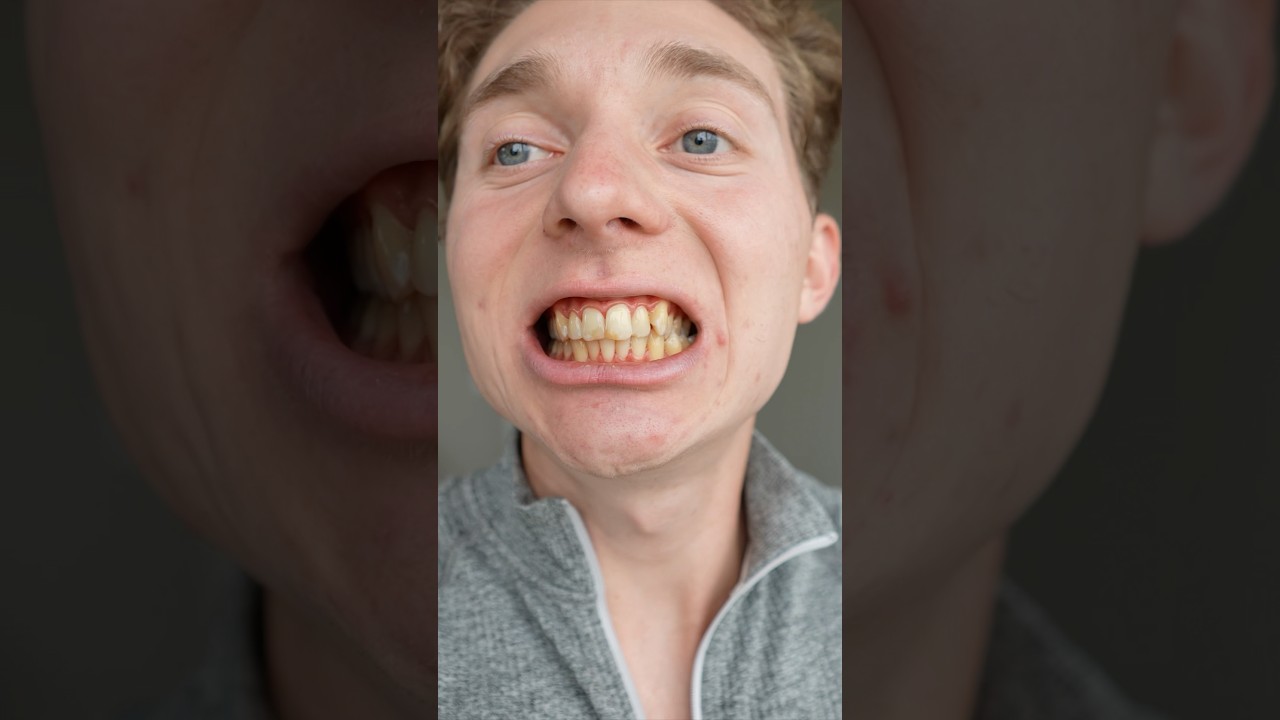 I Fixed My Rotting Teeth