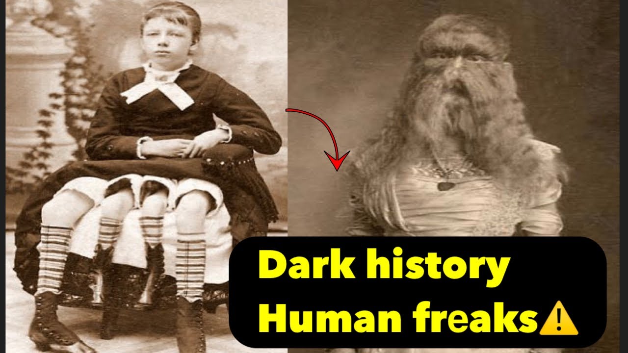 The Diabolical Truth About' Victorian Freak Show' Performers that actually existed in history