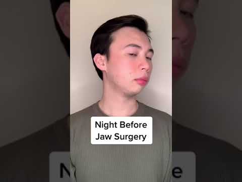 Jaw Surgery Transformation